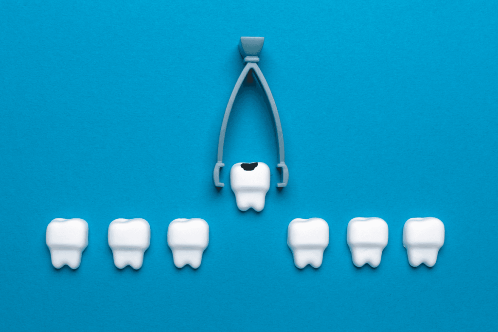 Root Canal Vs Tooth Extraction Which Is The Right Option For Me Root Canal Vs Tooth Extraction Which Is The Right Option For Me